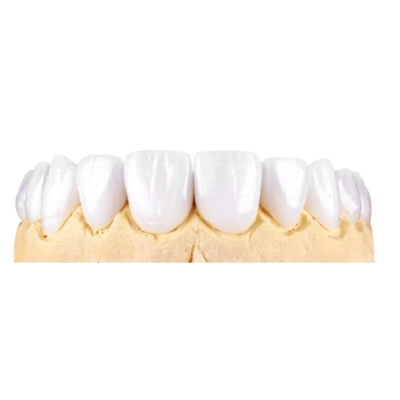 SỨ NACERA NATURAL - CÔNG TY CỔ PHẦN NHA KHOA VENUS SMILE